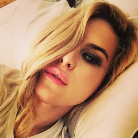 Rumer Willis transformation after chin plastic surgery