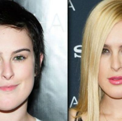 Rumer Willis transformation after chin plastic surgery
