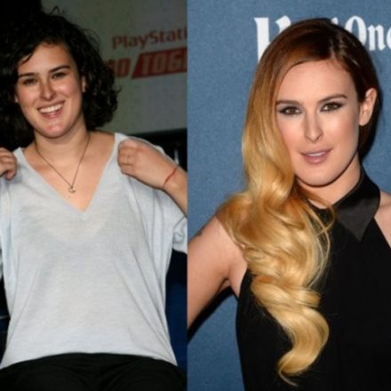 Rumer Willis transformation after chin plastic surgery