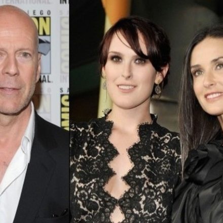 Rumer Willis transformation after chin plastic surgery