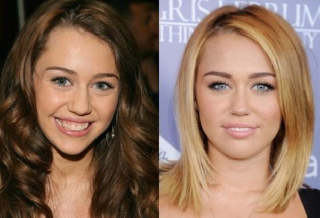 Miley Cyrus after Plastic Surgery?