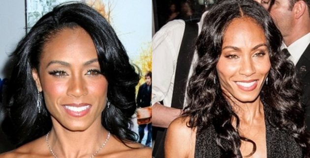 Jada Pinkett Smith Plastic Surgery, Really?