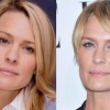 The naked truth about Robin Wright Plastic Surgery procedures