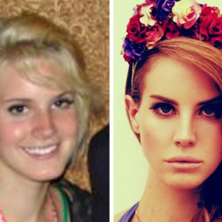 Could this be the case with Lana Del Rey plastic surgery?