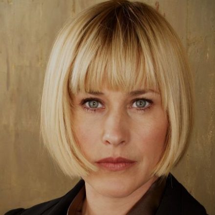 Plastic Surgery Made Patricia Arquette's Forehead Smoother