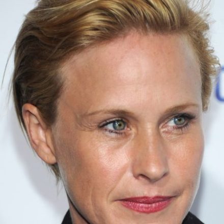 Plastic Surgery Made Patricia Arquette's Forehead Smoother