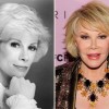 Joan Rivers Plastic Surgery - An Obsession
