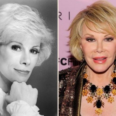 Joan Rivers Plastic Surgery - An Obsession