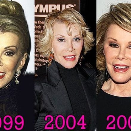Joan Rivers Plastic Surgery - An Obsession