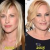 Plastic Surgery Made Patricia Arquette's Forehead Smoother