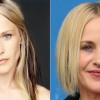 Plastic Surgery Made Patricia Arquette's Forehead Smoother