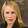 Plastic Surgery Made Patricia Arquette's Forehead Smoother