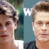 Rob Lowe Plastic Surgery Rumors