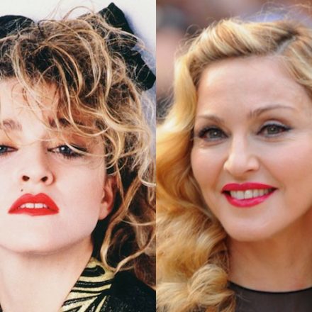 Madonna Plastic Surgery: Good Procedures or Epic Fail?