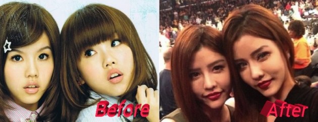 By2 Plastic Surgery:The twins that don't look like each other anymore