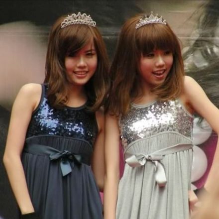 By2 Plastic Surgery:The twins that don't look like each other anymore