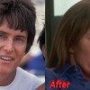 Bruce Jenner Plastic Surgery: From Male Athlete to Female Star