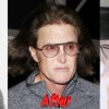 Bruce Jenner Plastic Surgery: From Male Athlete to Female Star