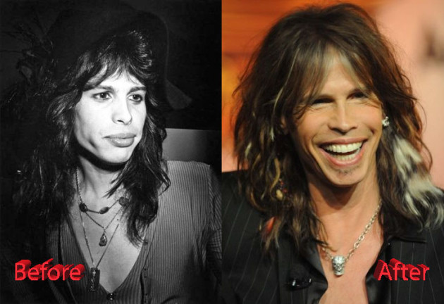 How Far Will Steven Tyler Go With Plastic Surgery?