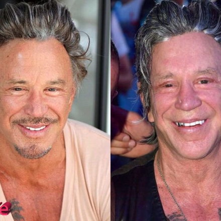 Mickey Rourke Plastic Surgery: Is It Enough?