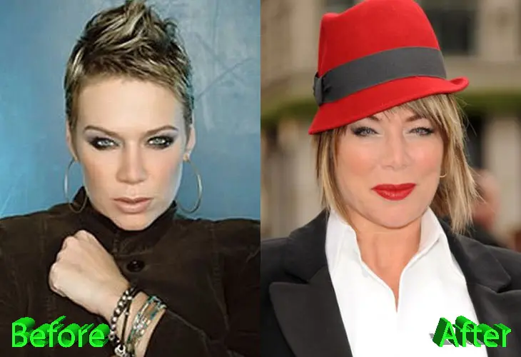 Mia Michaels Plastic Surgery and Rumors and Gossips About It