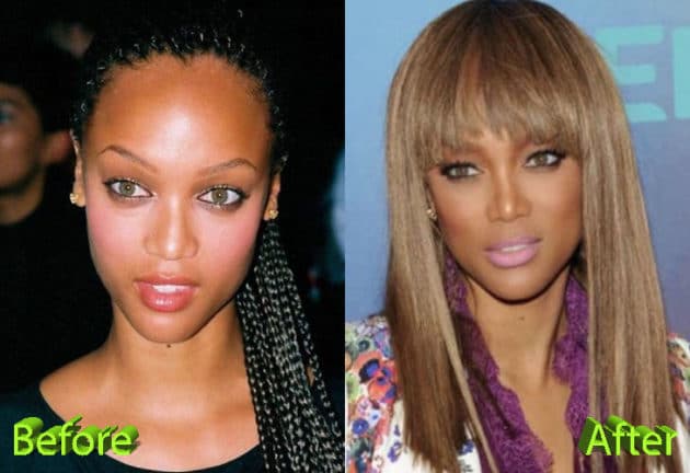 Tyra Banks Nose Job: The Cat Is Finally Out Of The Bag
